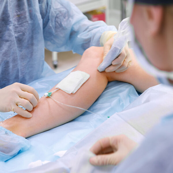 Angiolog Białystok – Leczenie żylaków i laserowe leczenie (EVLT)